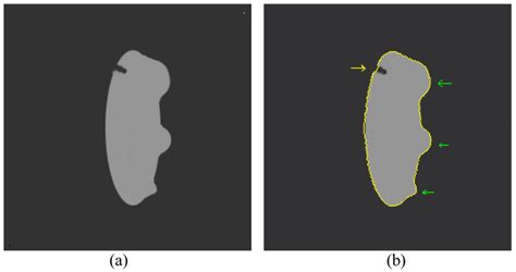 An Artificial Image Mimics The Bladder Wall Which Shows How The Bent Download Scientific