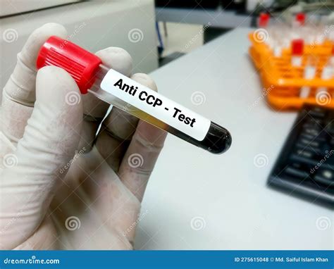 Anti Ccp Test Diagnosis Of Rheumatoid Arthritis Disease Cyclic Citrullinated Peptides Test