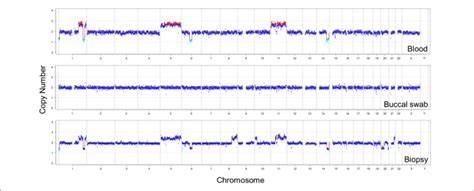 CNV Analysis Of The Patient S Autosomes And Sex Chromosomes Both Download Scientific Diagram
