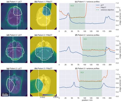 Image Variance Maps For The Three Patients For A D G Pct And B E Download Scientific