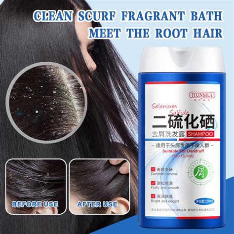 Selenium Sulfide Anti Dandruff Shampoo Oil Control Anti Psoriasis Itching Ketoconazole Shampoo