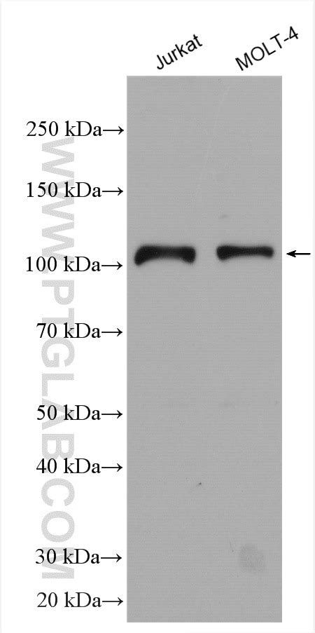 Rig 1ddx58 Antibody 20566 1 Ap Proteintech