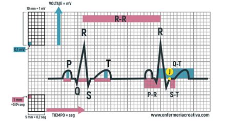 Como Interpretar Un Ecg Enfermería Creativa