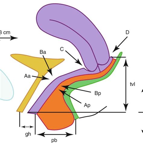 4 Uterine Descent The Cervix Protrudes Beyond The Hymenal Ring With