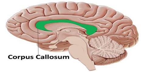 Corpus Callosum Assignment Point