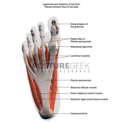 What Is Plantar Fasciitis