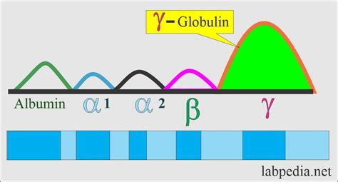 Serum Protein Electrophoresis Total Protein Albumin And Globulin