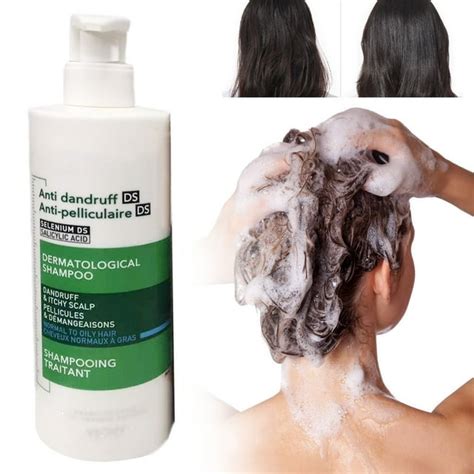 Selenium Sulfide Anti Dandruff Shampoo Anti Shampoo Flaky And