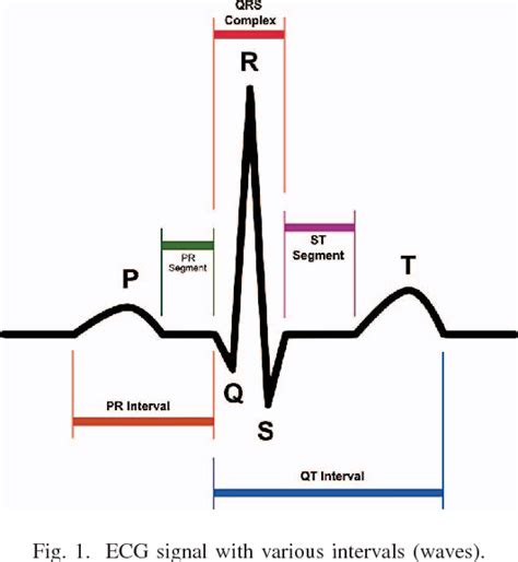 Figure 1 From A Feasible Qrs Detection Algorithm For Arrhythmia