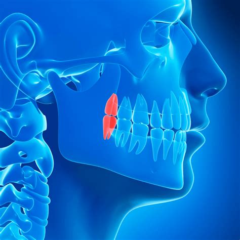 Wisdom Teeth Crystalline Dental