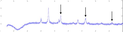 X Ray Diffraction Peaks Associated With Fenps Download Scientific