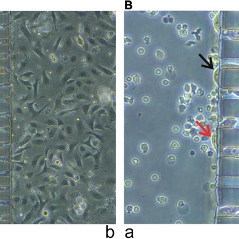 Simulation Of Metastasis Using A Microfluidic Chip Immune Cells From A