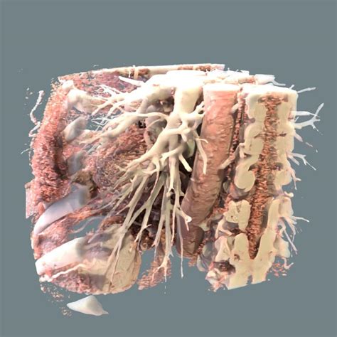 Segmentation Of The Thoracic Aorta In Contrast Enhanced Ct Images