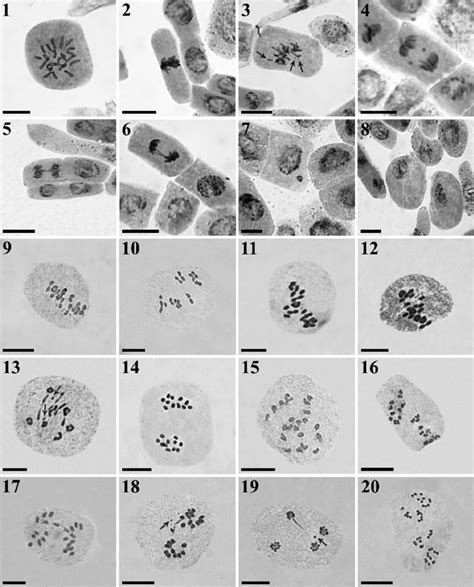 Metaphase Of Mitosis Under Microscope How To Identify Stages Of Mitosis Within A Cell Under A