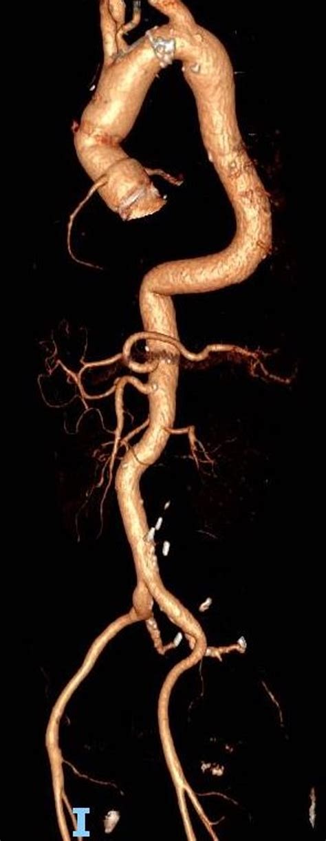 Control Ct Scan Before Discharging Download Scientific Diagram