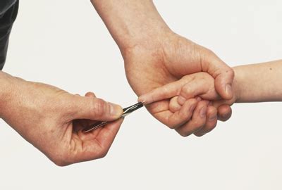 3 Ways To Remove A Splinter Survival Stronghold