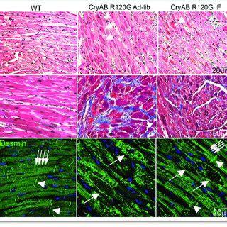 Normal Barium Swallow Which Done On 3 Rd And 1 St Days Post Operation Download Scientific