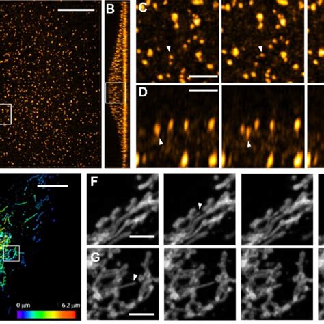 Pdf Resolution Doubling In Light Sheet Microscopy Via Oblique Plane Structured Illumination