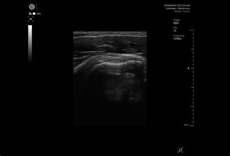 Ultrasound Greentact Healthcare