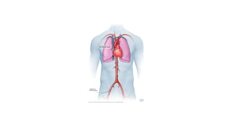 How Much Does A Cag Test Cost In Bangladesh Cardiology Bangladesh
