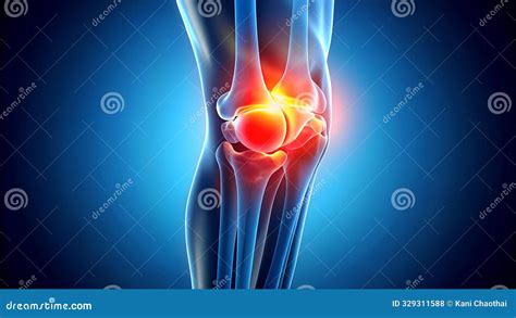 Inflamed Knee Joint A Visual Depiction Of Pain And Swelling Ai