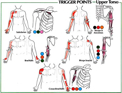 Trigger Points Upper Torso Massage Therapy Pinterest