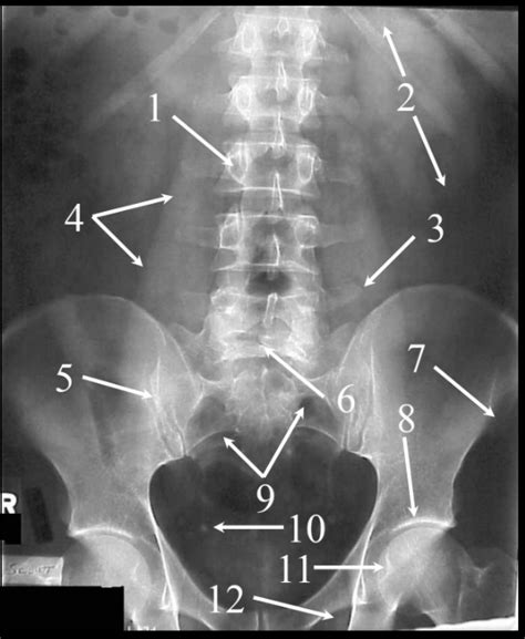 Kub Xray Labeled At Hayden Atkin Blog