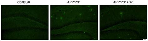 Histological Examples Of Thioflavin S Staining In The Hippocampus And