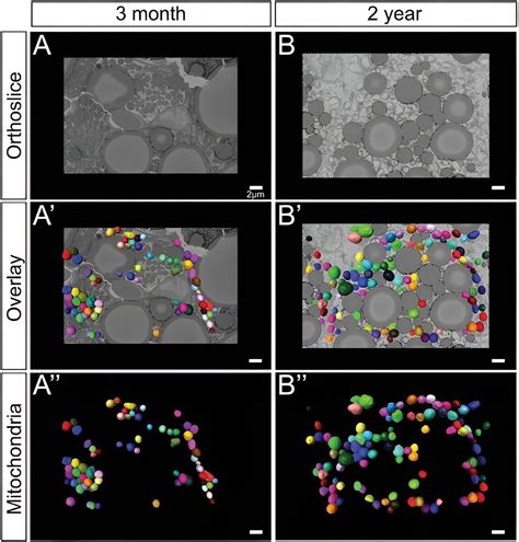 Researchers Map Structure Of Mitochondria At Different Life Stages