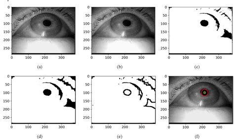 Figure 1 From A New Pupil Detection Algorithm Based On Circular Hough Transform Approaches