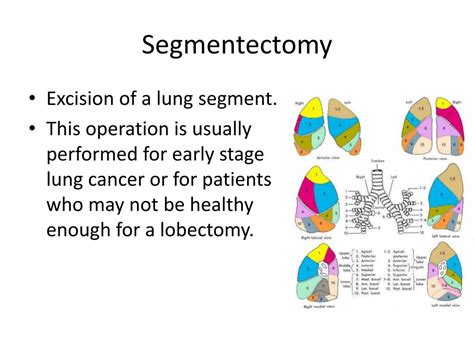 Ppt Cardiothoracic Surgery Powerpoint Presentation Free Download Id2466176