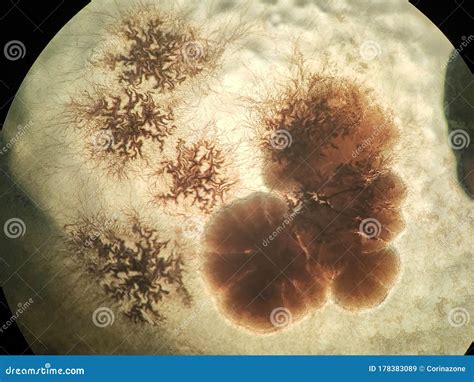 Bacilli Bacteria Microscope