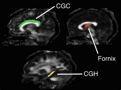 Figure 1 From Procedural And Declarative Memory Brain Systems In