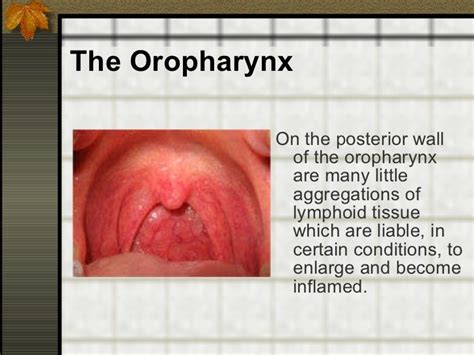 What Are Throat Cobblestones At Jay Hunter Blog