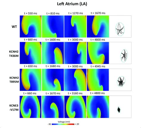 Simulation Of Spiral Waves In 2d Left Atrium In Control Wt And