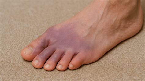 Purple Toes Uk