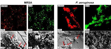 Antibacterial Testing Using Mrsa And P Aeruginosa Bacteria Incubated Download Scientific