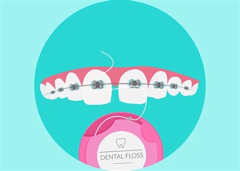 How To Floss With Braces For A Better Experience