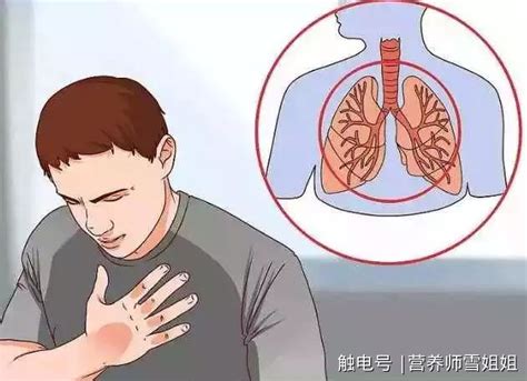 肺癌杵状指图片肺的忤状指图片轻度杵状指图片第10页大山谷图库