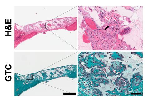 Decellularized Apple Derived Scaffolds For Bone Tissue Engineering In