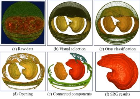 The Intermediate And Final Results Of The Segmentation Process