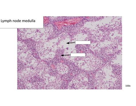 Lymph Node Medulla Quiz