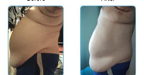 430 Pound Man Vs Weight Loss Week 6 Accountability Post 3rd Goal