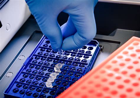 Diagnosing Lupus Ladies Of Lupus