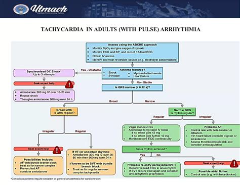 arritmias algorithm ppt