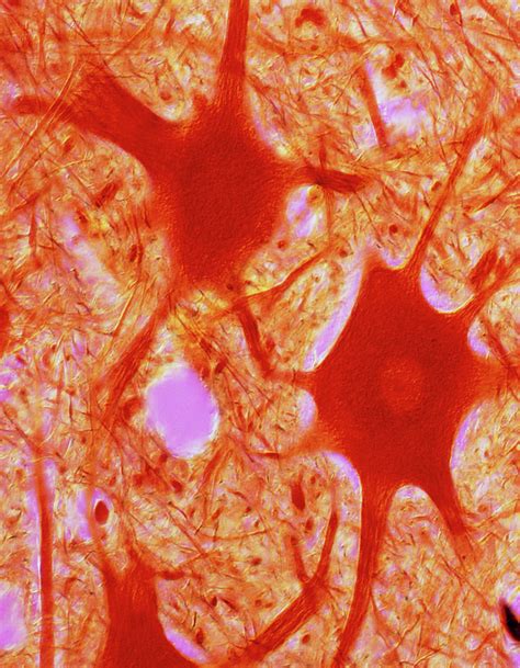 F Colour Lm Of Nerve Cells In The Human Brain Greeting Card By Science Photo Library