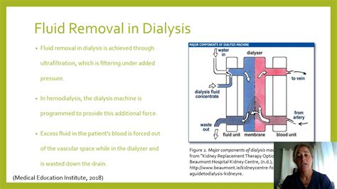 Calculating And Understanding Ultrafiltration Goals Youtube