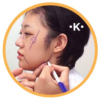 How To Achieve A V Line Face Shape Korean Tips And Tricks