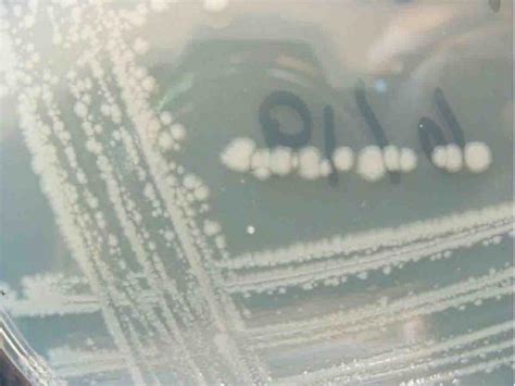 Staphylococcus Epidermidis Streak Plate