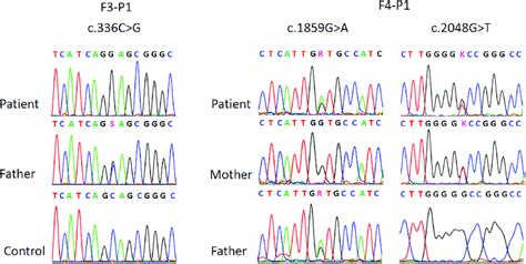 Partial Electropherograms From Sanger Sequencing Showing The Mutations
